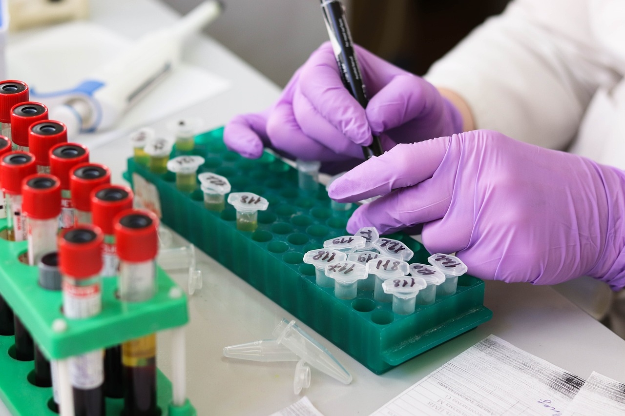 SALK SCIENTISTS DISCOVER ANTI-INFLAMMATORY MOLECULES THAT DECLINE IN ... SALK SCIENTISTS DISCOVER ANTI-INFLAMMATORY MOLECULES THAT DECLINE IN ...